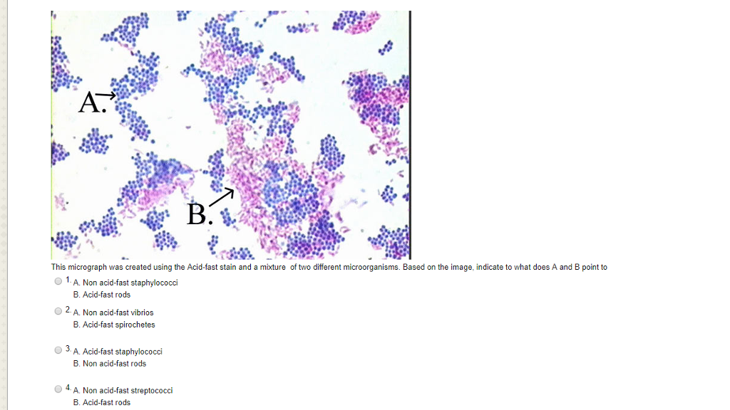 Solved This micrograph was created using the Acid-fast stain | Chegg.com