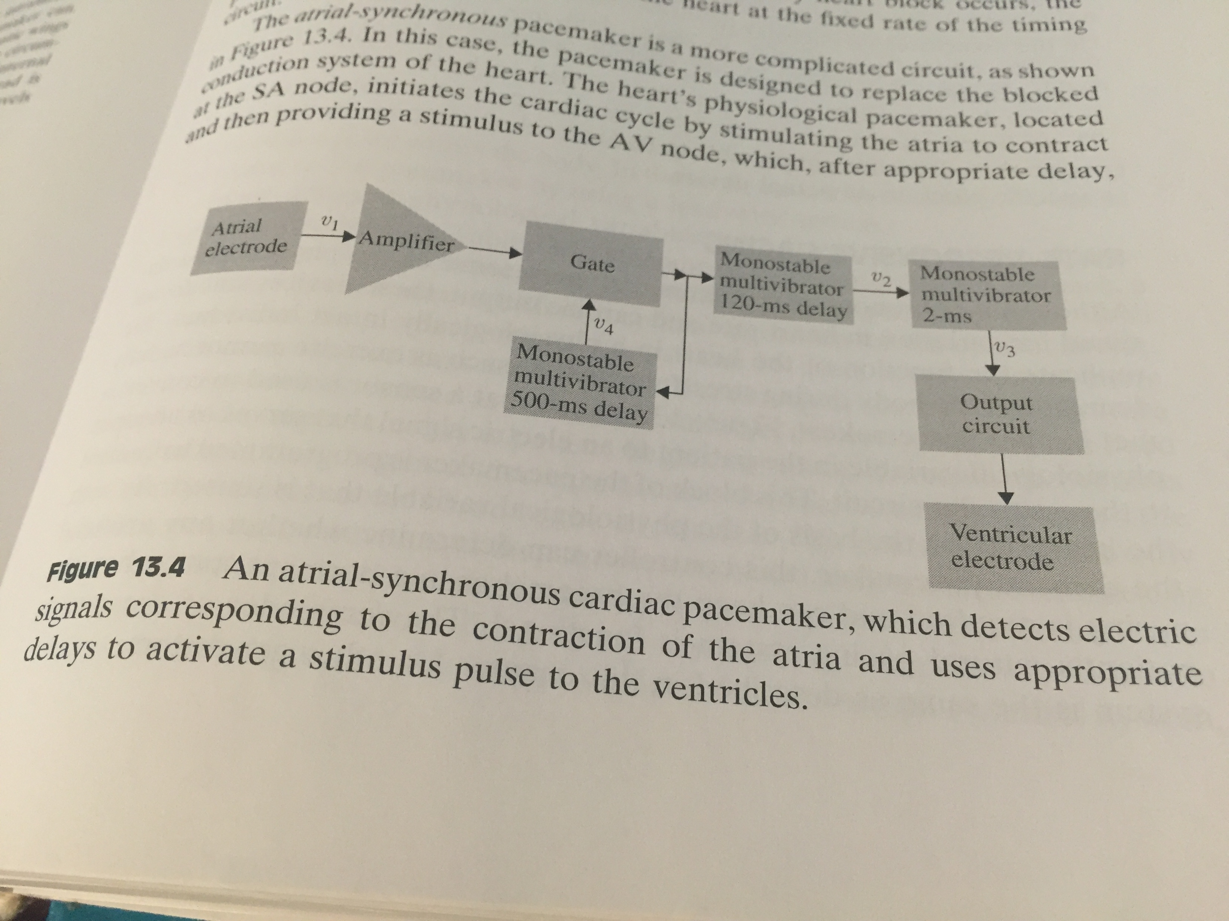 How might the atrial-synchronous pacemaker shown in | Chegg.com