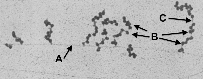 Solved The micrograph below shows polysomes, which are | Chegg.com