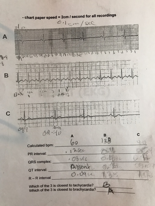 Solved D. Calculate the bpm, PQ, ST & QT intervals time) for | Chegg.com