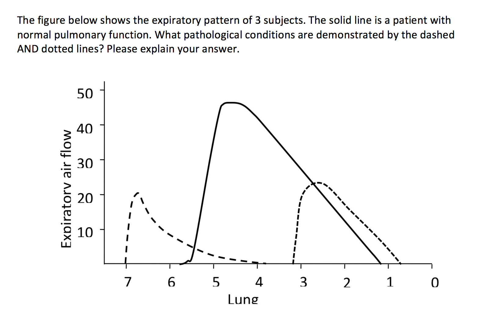 Solved The figure below shows the expiratory pattern of 3 | Chegg.com