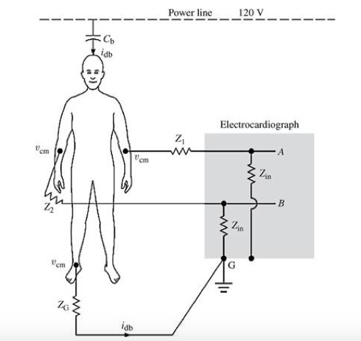 Solved A student attempts to measure his own ECG on an | Chegg.com