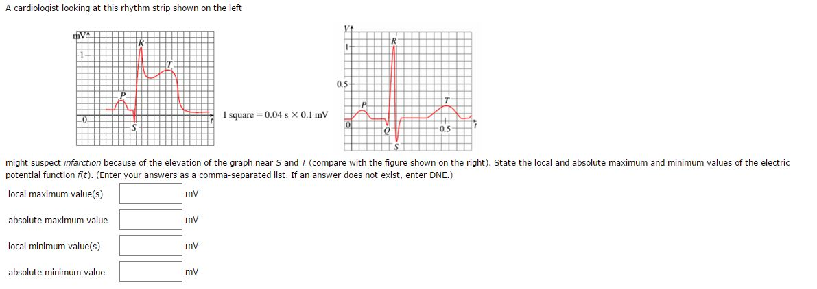 Solved A cardiologist looking at this rhythm strip shown on | Chegg.com