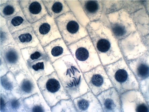 Experiment 1: Observation of Mitosis in a Plant Cell | Chegg.com