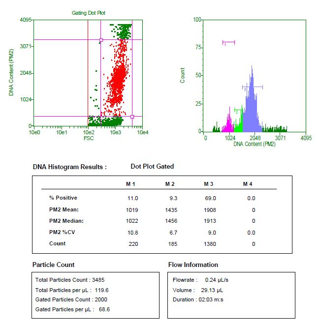Solved Interpret Histograms Briefly describe the | Chegg.com