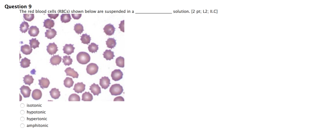 Solved Question 9 The red blood cells (RBCs) shown below are | Chegg.com