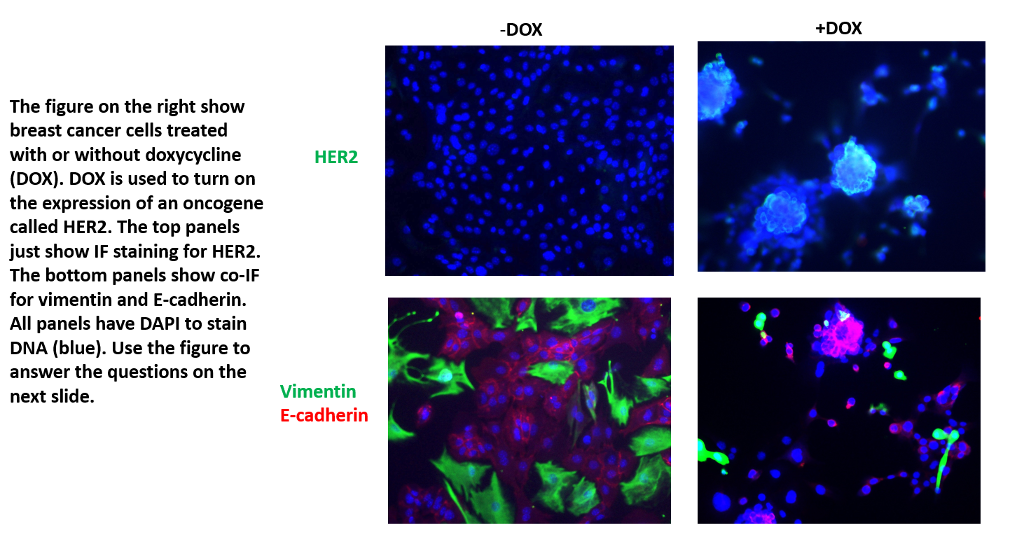 Solved DOX +DOX The figure on the right show breast cancer | Chegg.com