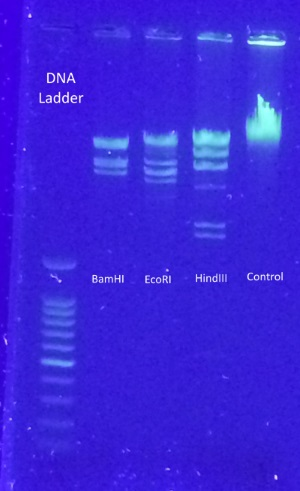 Solved Restriction enzyme digest of the bacteriophage lambda | Chegg.com