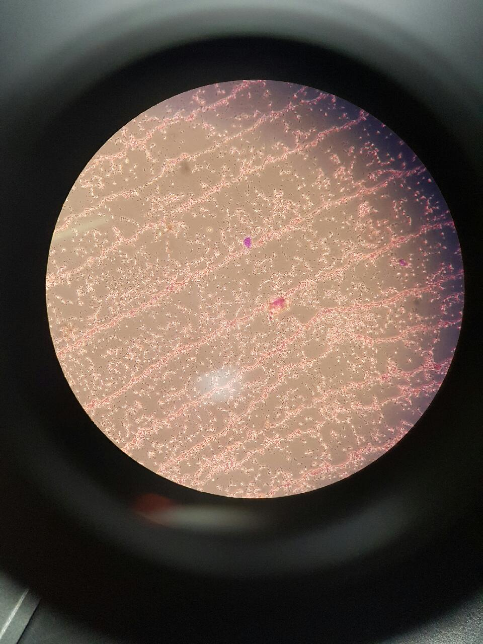 Solved Gram-staining | Chegg.com