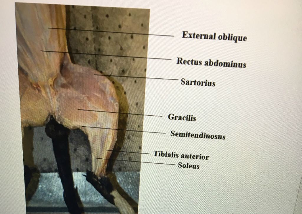 Solved Tensor fasciae latae location on image. Is this lmage | Chegg.com
