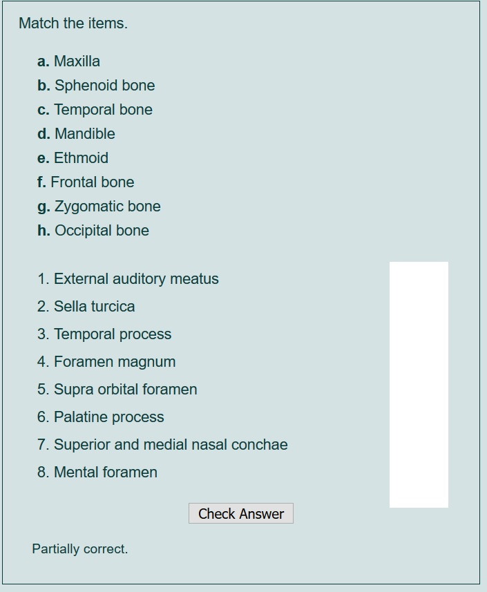 Solved Match the items. a. Maxilla b. Sphenoid bone c. | Chegg.com