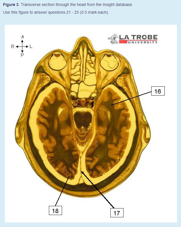 Solved Figure 3. Transverse section through the head from | Chegg.com
