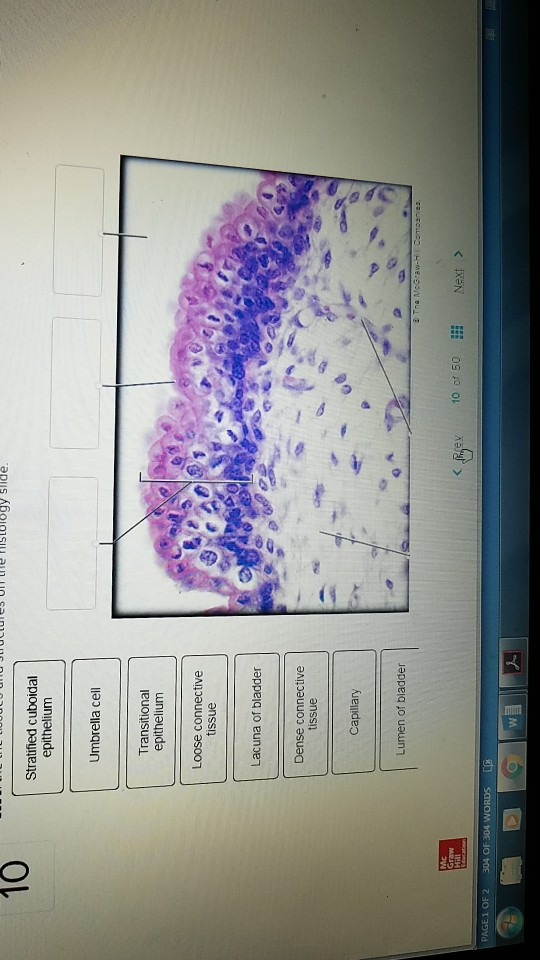 Solved labelthe tissue andstructures on the histology slide. | Chegg.com