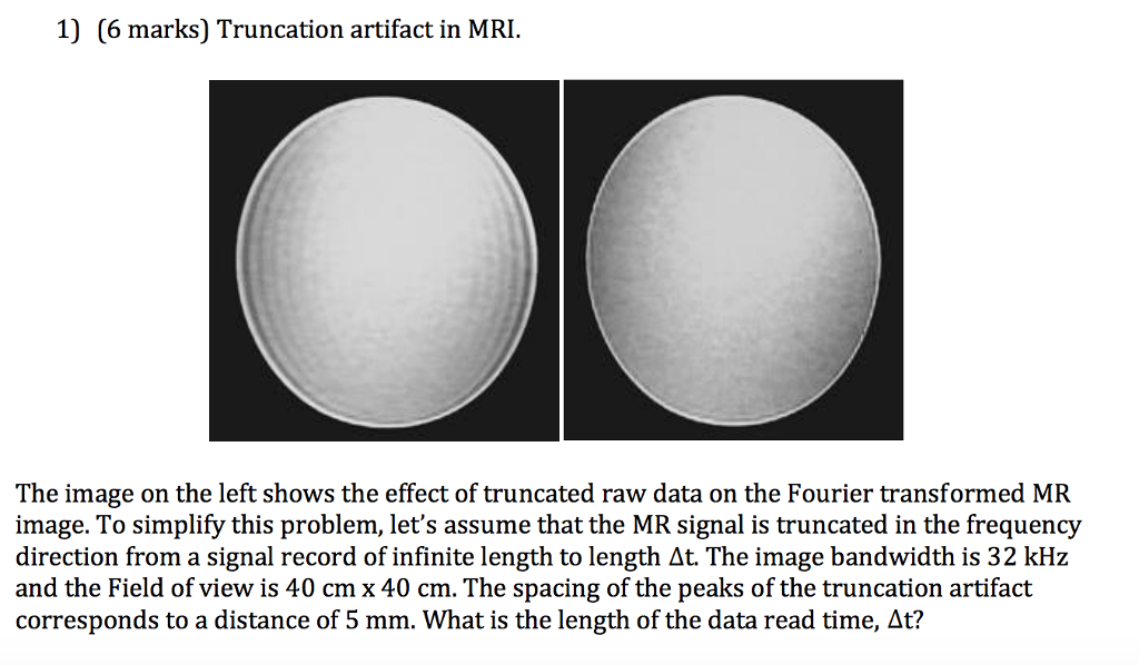 Solved Truncation Artifact In Mri The Image On The Left