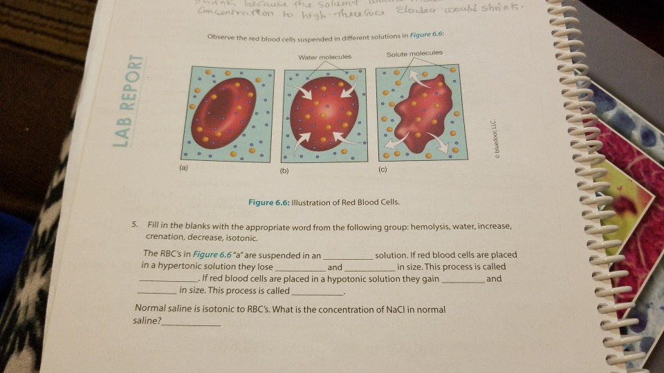 Solved Observe the red blood cells suspended in different | Chegg.com