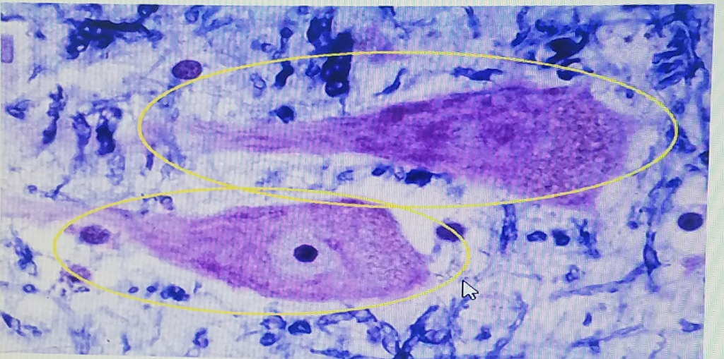Solved Which part of this muscle tissue are the yellow | Chegg.com