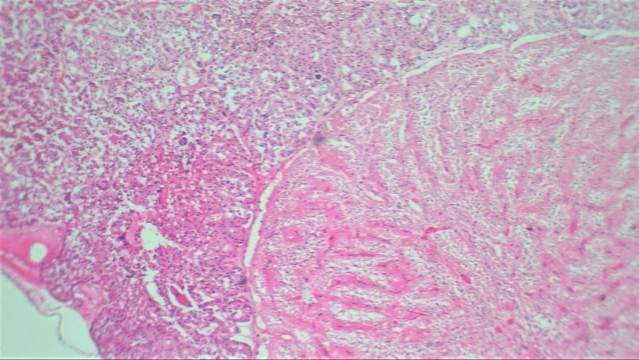 Solved Picking one of the three slide (one is at low power, | Chegg.com