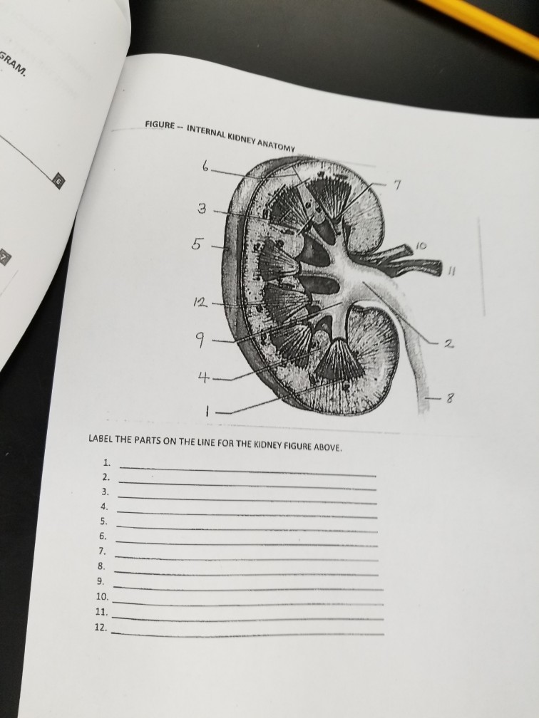 Solved FIGURE INTERNAL KIDNEY ANATOMY 3 iO 12. 4 LABEL THE | Chegg.com