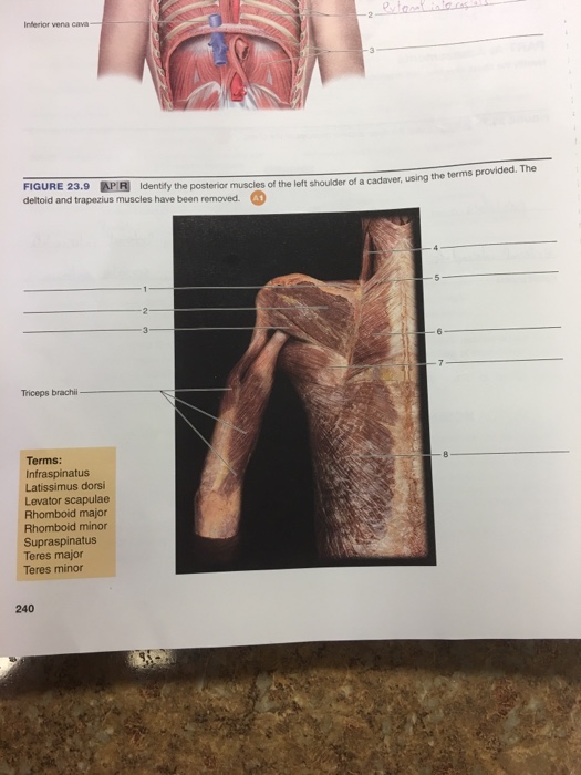 Solved Identify the posterior muscles of the left shoulder | Chegg.com