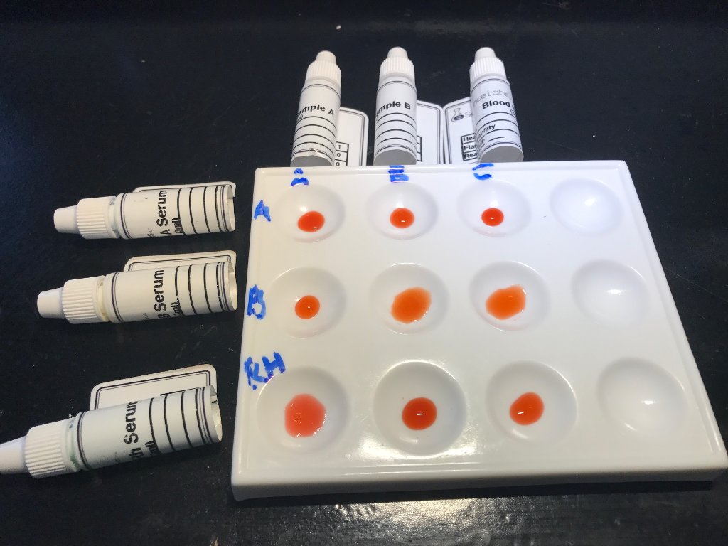 Solved Background INFO There are four types of blood: A, | Chegg.com