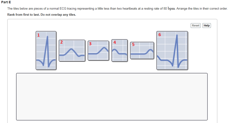 Solved The tiles below are pieces of a normal ECG tracing | Chegg.com
