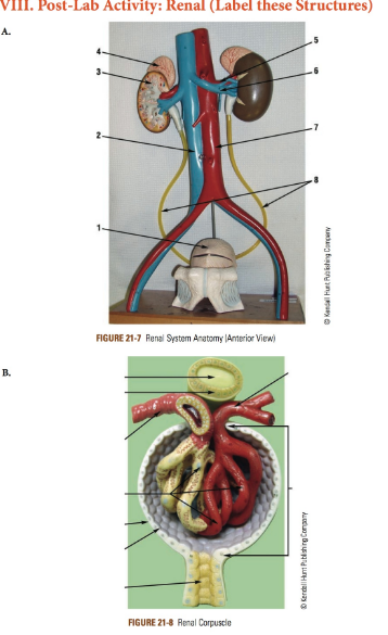 Solved VIII.Post-Lab Activity: Renal (Label these | Chegg.com