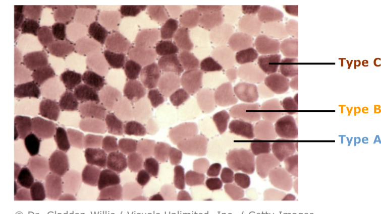 Solved Skeletal muscles usually consist of several distinct | Chegg.com