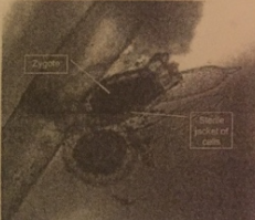 Solved The figure shows a sterile jacket of cells | Chegg.com