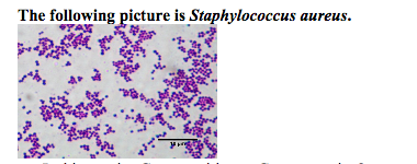 Solved LAB MODULE: STAINING– STUDY HELP Instructions: | Chegg.com