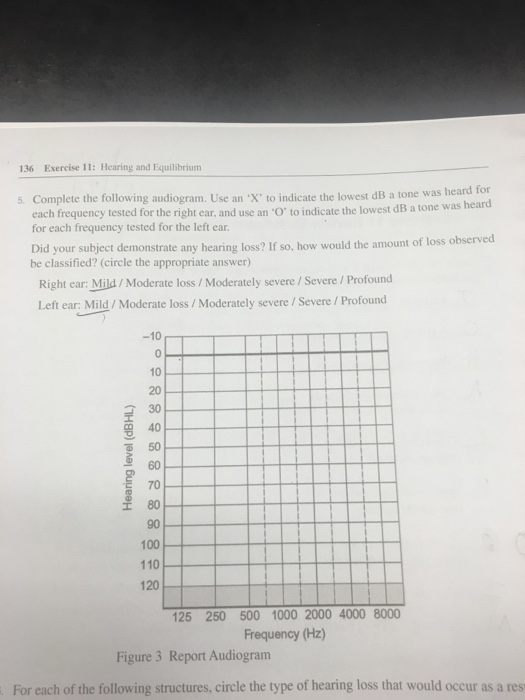 Complete the following audiogram. Use an 'X' to | Chegg.com
