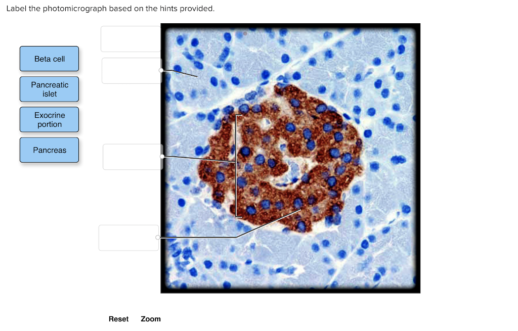 Solved Label the photomicrograph based on the hints | Chegg.com