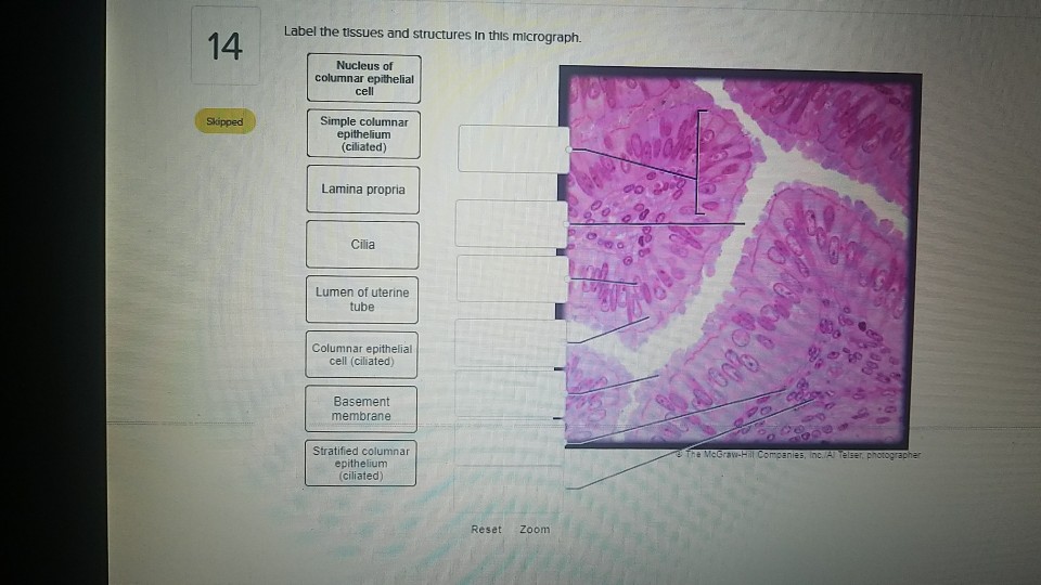 Solved Label the tissues and structures in this micrograph. | Chegg.com