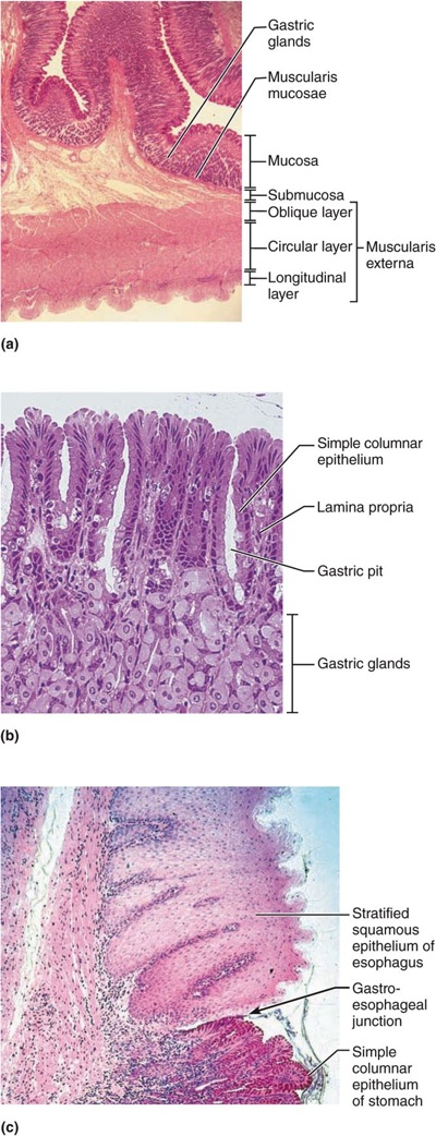Solved Gastric glands Muscularis mucosae -Mucosa Submucosa | Chegg.com