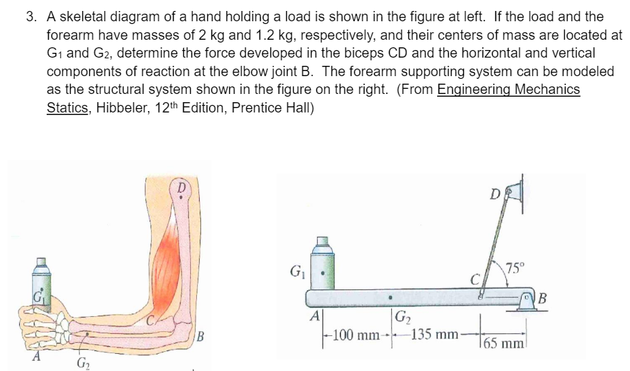 Solved A skeletal diagram of a hand holding a load is shown | Chegg.com