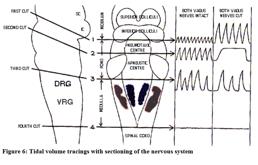 Solved The third cut severs the apneustic centre. Now the | Chegg.com