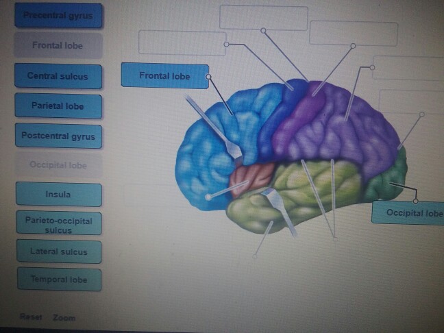 Solved Precentral gyrus Frontal lobe Frontal lobe Central | Chegg.com