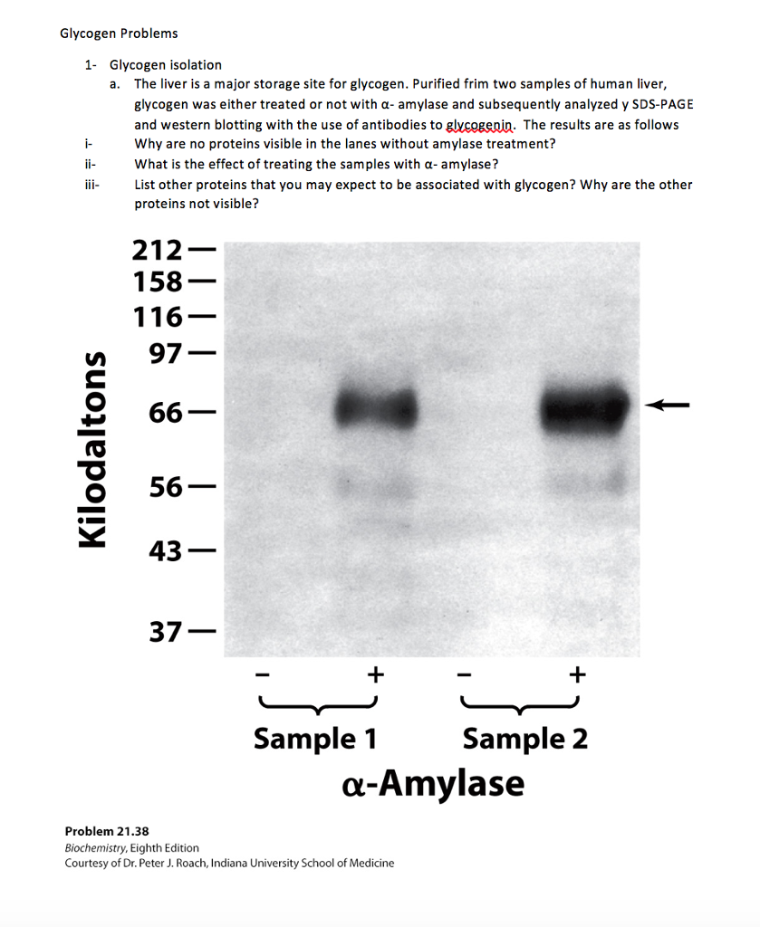 Liver Amylase Treated