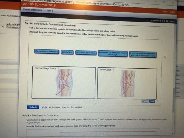 Solved Bone Growth, Fractures and Remodeling Part of the | Chegg.com