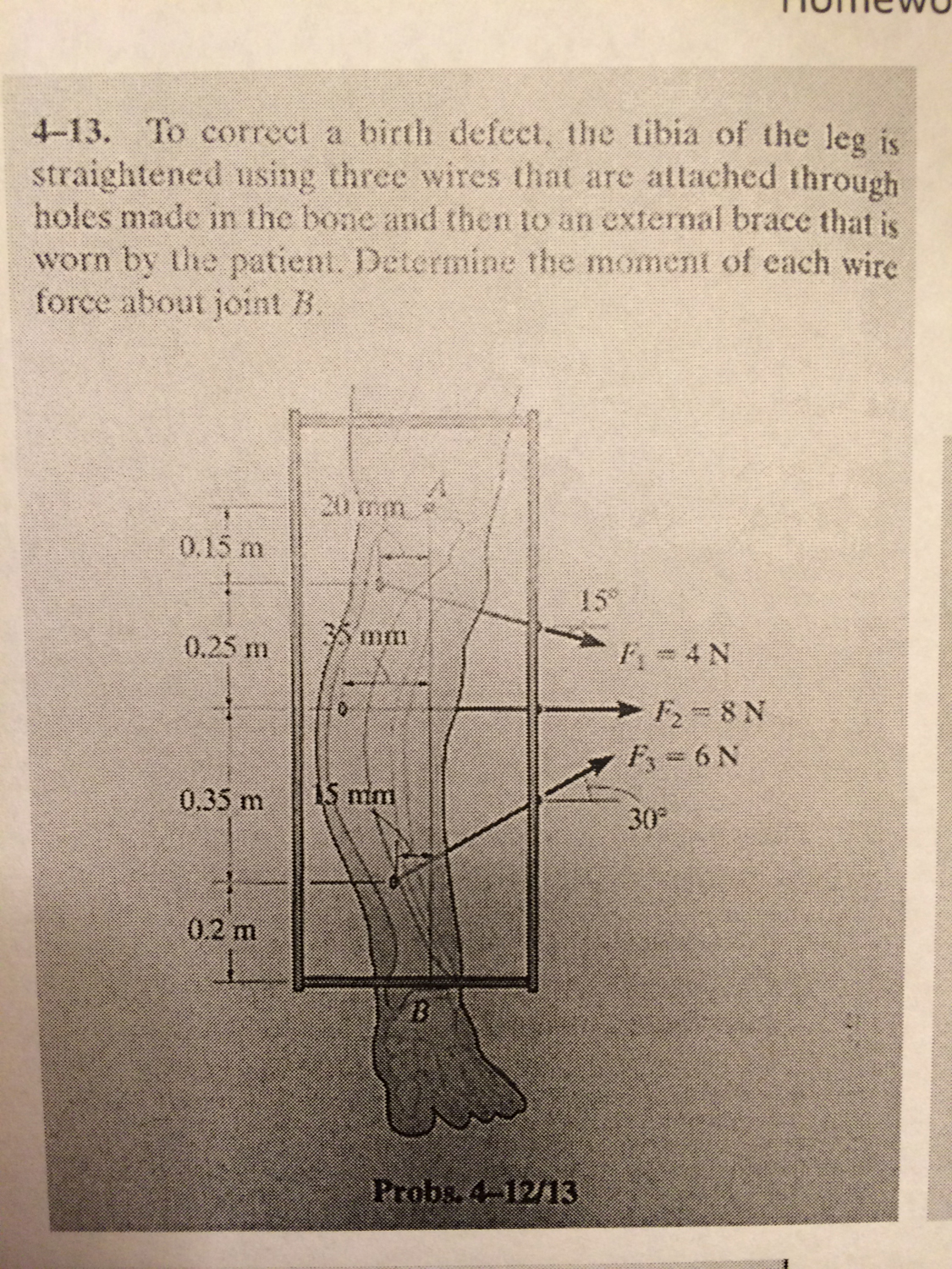 Solved 4-13. To correct a birth defect, the libia of the leg | Chegg.com