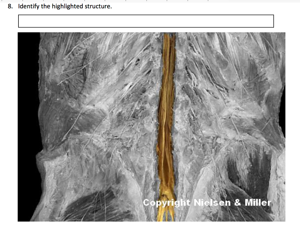 Solved 8. Identify the highlighted structure. Copyright | Chegg.com