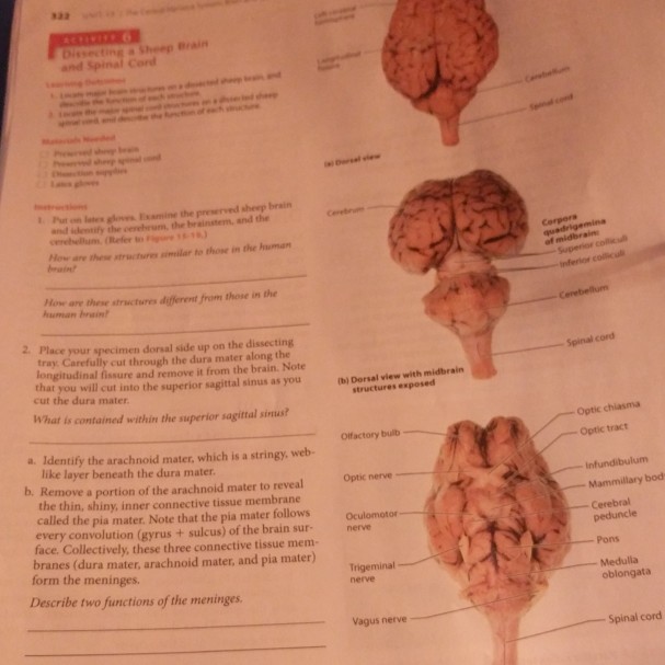Solved Dissecting a Sheep Brain and Spinal Cord 1 Put on | Chegg.com