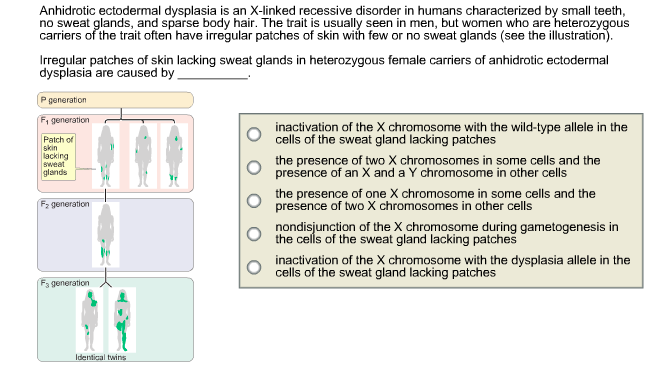 Solved: Anhidrotic Ectodermal Dysplasia Is An X-linked Rec... | Chegg.com