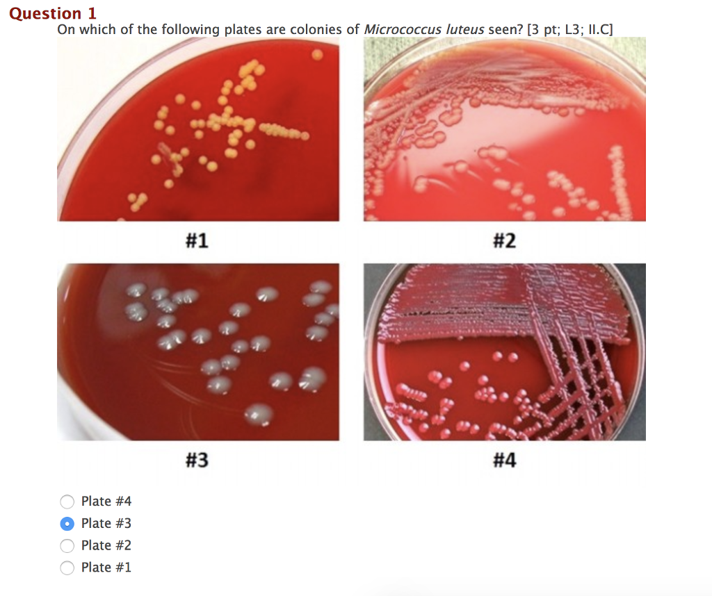 Solved Question 1 On which of the following plates are | Chegg.com