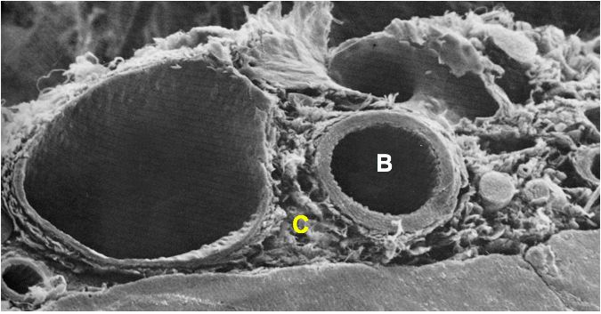 Solved This is an image of blood vessels. A. This image was | Chegg.com