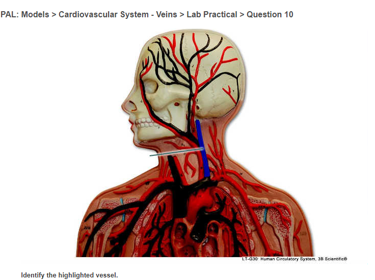 Solved PAL: Models > Cardiovascular System - Veins > Lab | Chegg.com