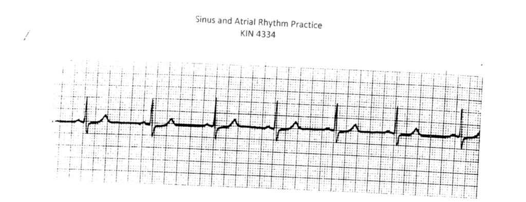 Solved IDENTIFY each one of the rhythms using the process of | Chegg.com