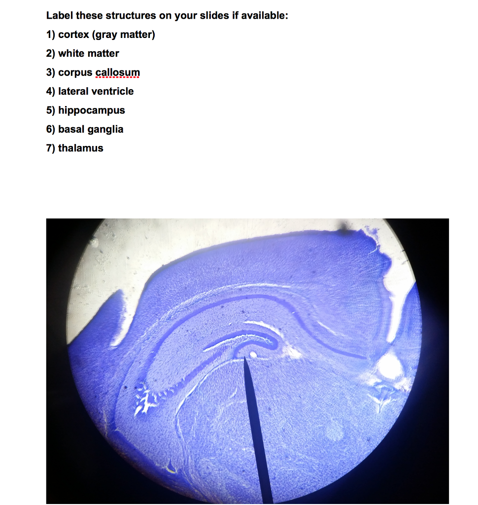 Solved Label these structures on your slides if available: | Chegg.com