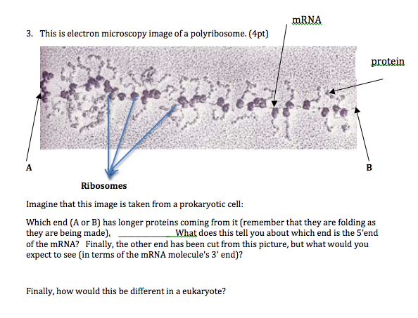 This is electron microscopy image of a polyribosome. | Chegg.com