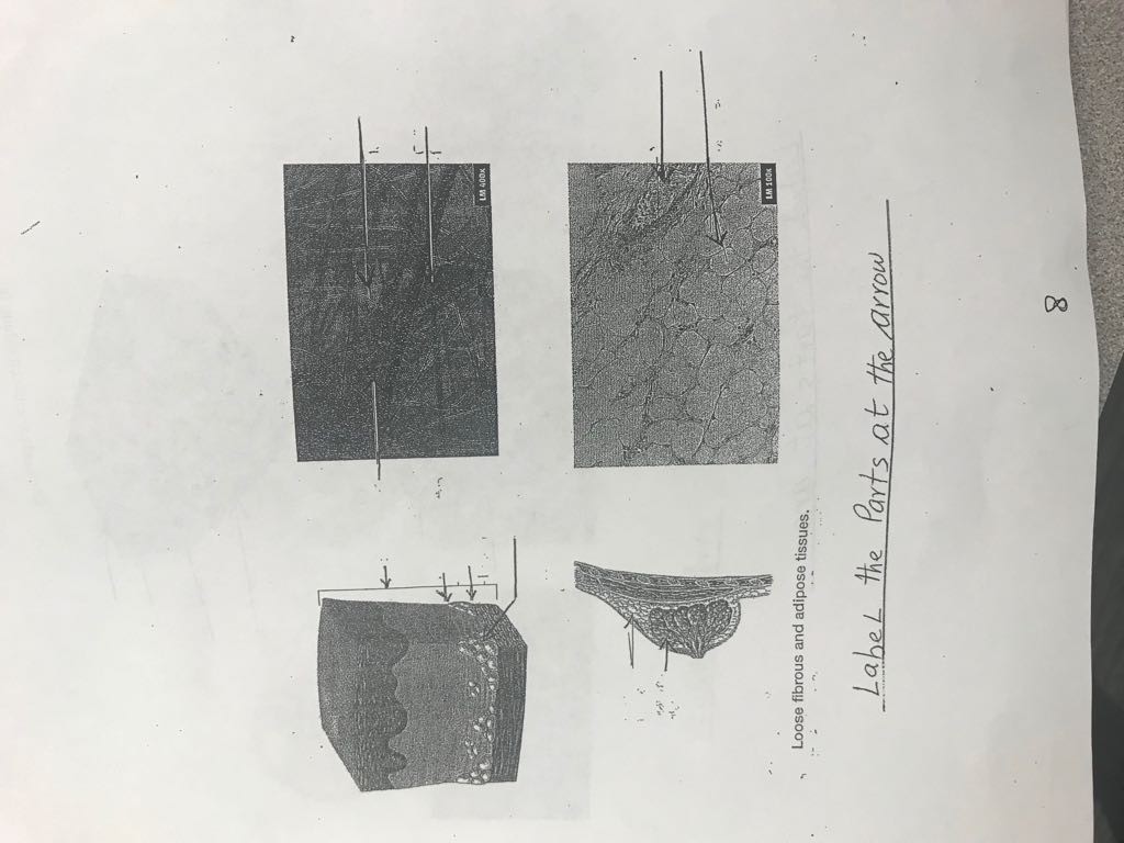LIA Loose fibrous and adipose tissues. | Chegg.com
