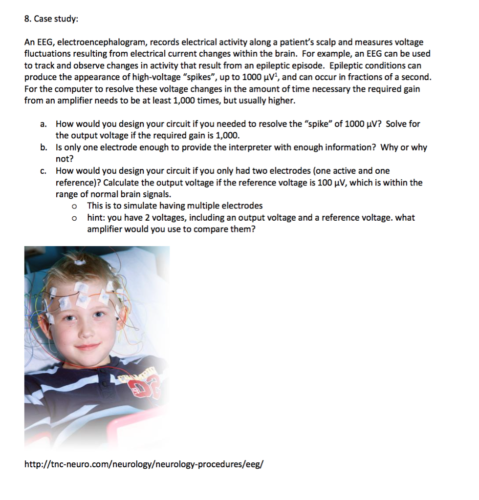 Case study: An EEG, electroencephalogram, records | Chegg.com
